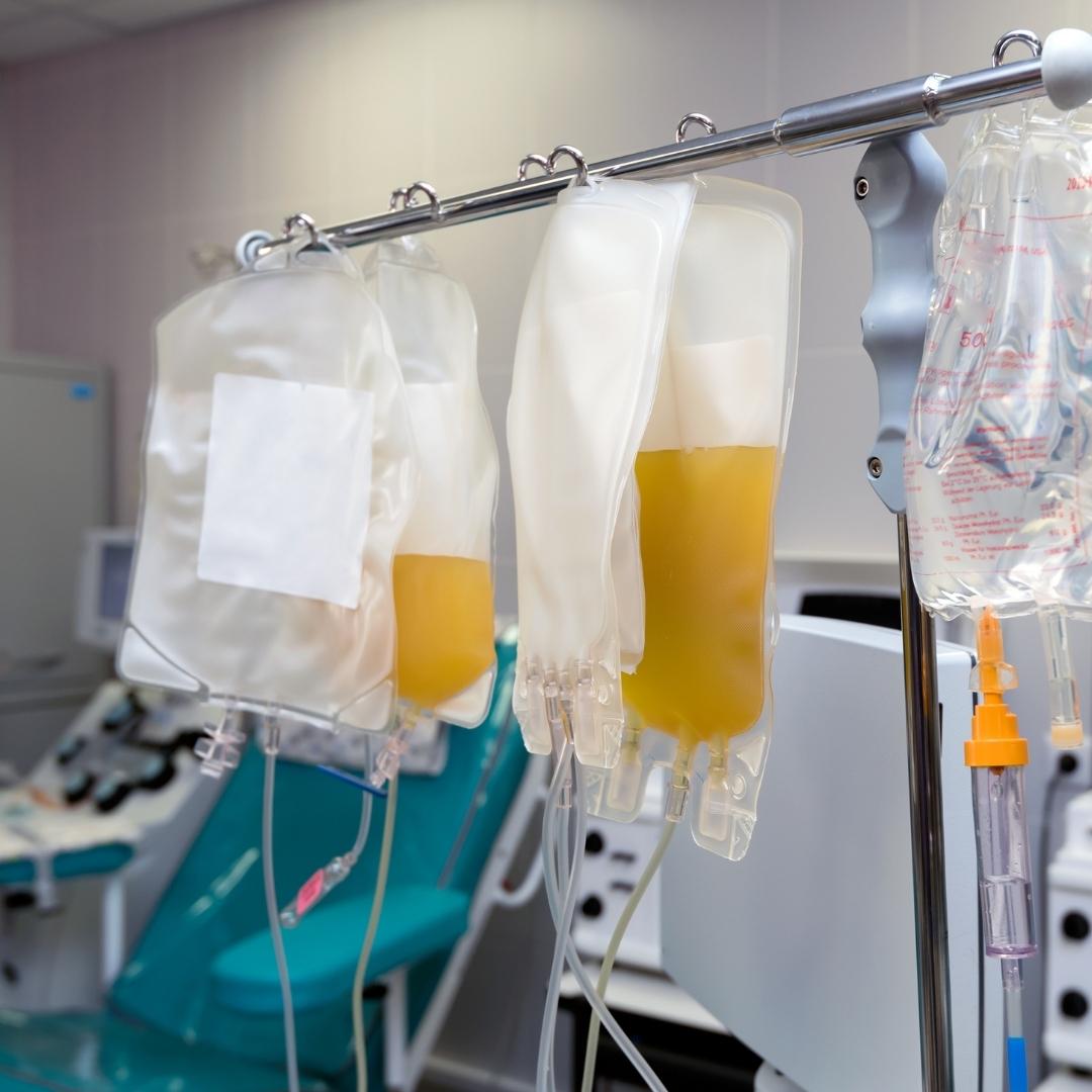 Apheresis: what you need to know