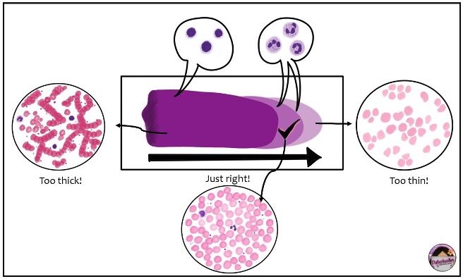 The Blood Smear – A Story Writing Exercise - Blood Academy